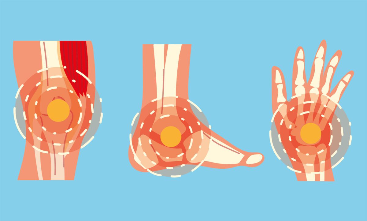 How to Strengthen Your Bones and Joints – Trust Inform