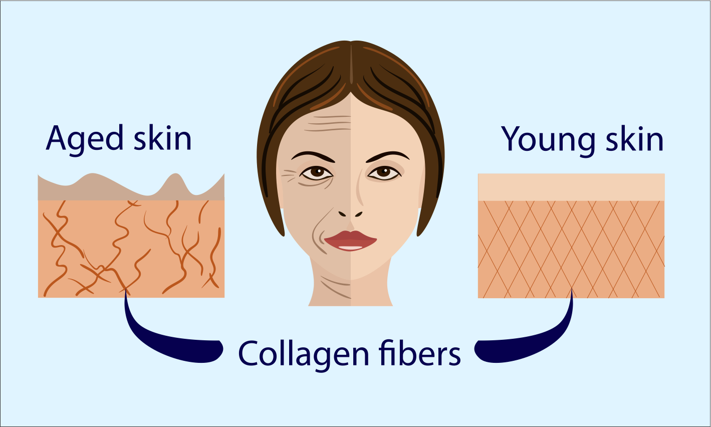 What is the Difference Between Collagen Types – Trust Inform